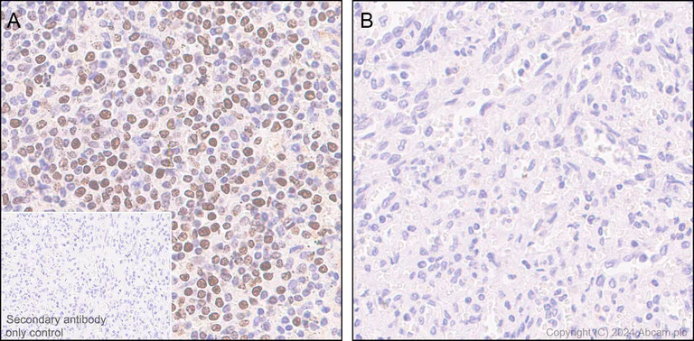 Anti-ATR (phospho S428) antibody [EPR25772-3F09] (ab316925) | Abcam