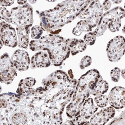 Atrophin 1抗体 (ab224142)| Abcam中文官网