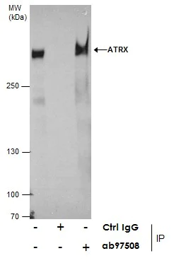 ATRX抗体 (ab97508)| Abcam中文官网