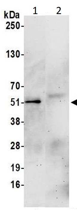 Anti-Aurora A antibody - Centrosome Marker (ab1287) | Abcam