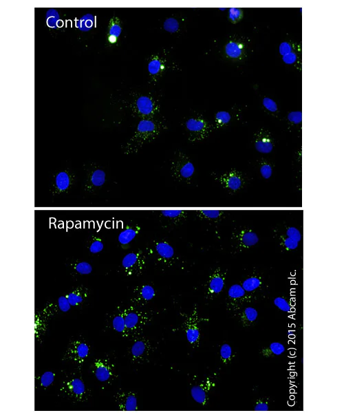 Autophagy Assay Kit (Fluorescent) (ab139484) | Abcam