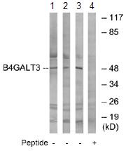 Anti-B4GALT3 antibody (ab74825) | Abcam