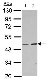 Anti-BAAT antibody (ab154918) | Abcam