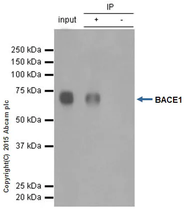 Anti-BACE1 antibody [EPR3956] - BSA and Azide free (ab237595) | Abcam