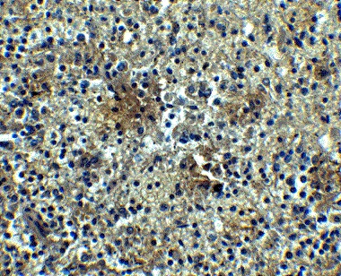 BAFF-R抗体 (ab5965)| Abcam中文官网