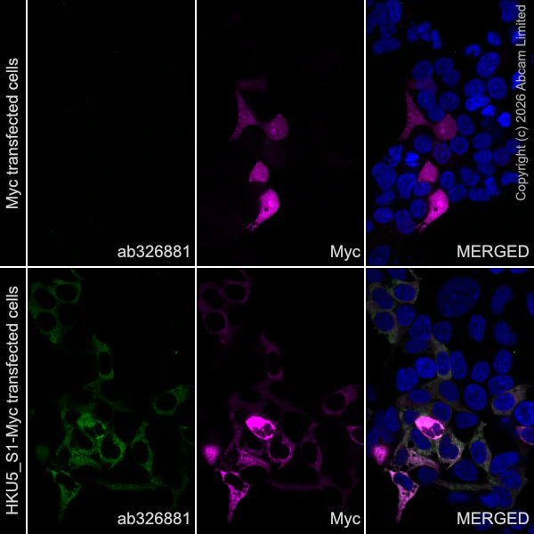 Anti-Bat coronavirus HKU5 Spike protein S1 (RBD domain) antibody ...