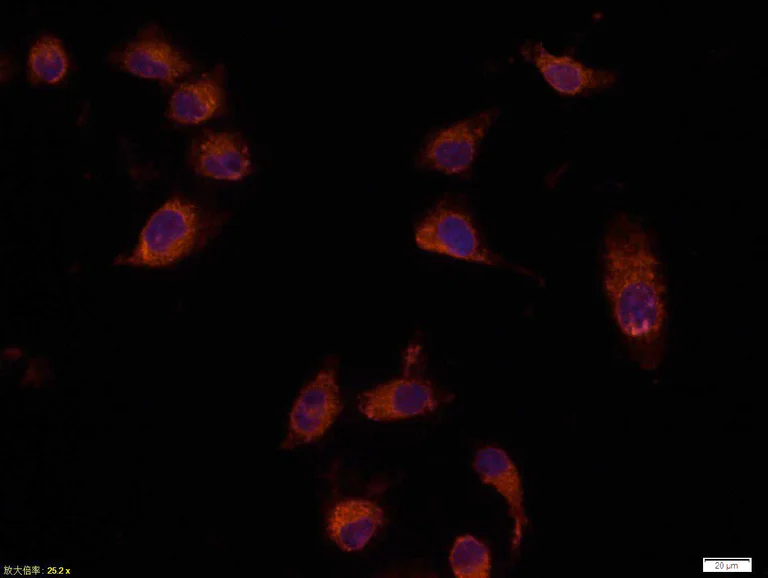 Anti-Bax antibody (ab216494) | Abcam