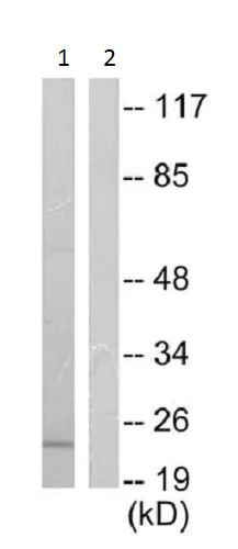 Anti-Bax antibody (ab53154) | Abcam