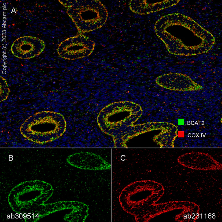 Anti-BCAT2 antibody [EPR27488-91] - BSA and Azide free (ab309515) | Abcam