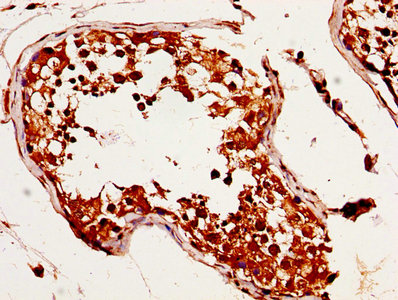 Anti-BCG1 antibody (ab236592) | Abcam
