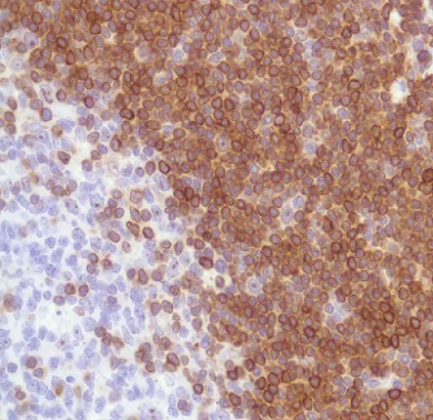 Bcl2 alpha抗体[SP66] - BSA and Azide free (ab236221)| Abcam中文官网