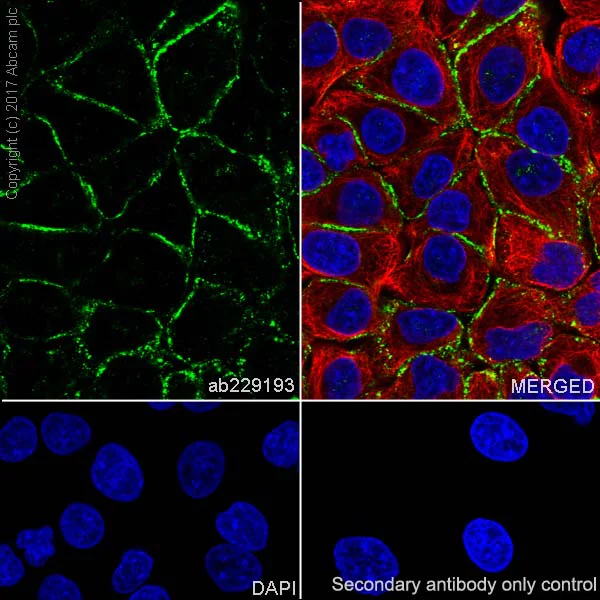 Anti-BCRP/ABCG2 antibody [EPR21122] (ab229193) | Abcam