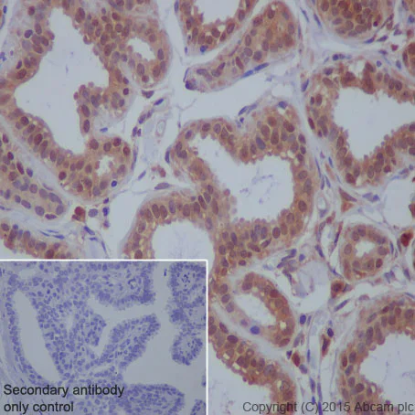 Anti-beta Arrestin 1 antibody [E274] Rabbit monoclonal (ab32099) | Abcam