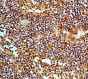 Anti-beta Arrestin 1 antibody [E274] Rabbit monoclonal (ab32099) | Abcam