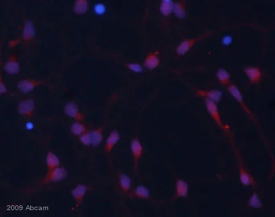 beta Catenin(磷酸化Y142)抗体 (ab27798)| Abcam中文官网