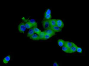 beta glucuronidase (GUSB)抗体[EPR10616] (ab166904)| Abcam中文官网