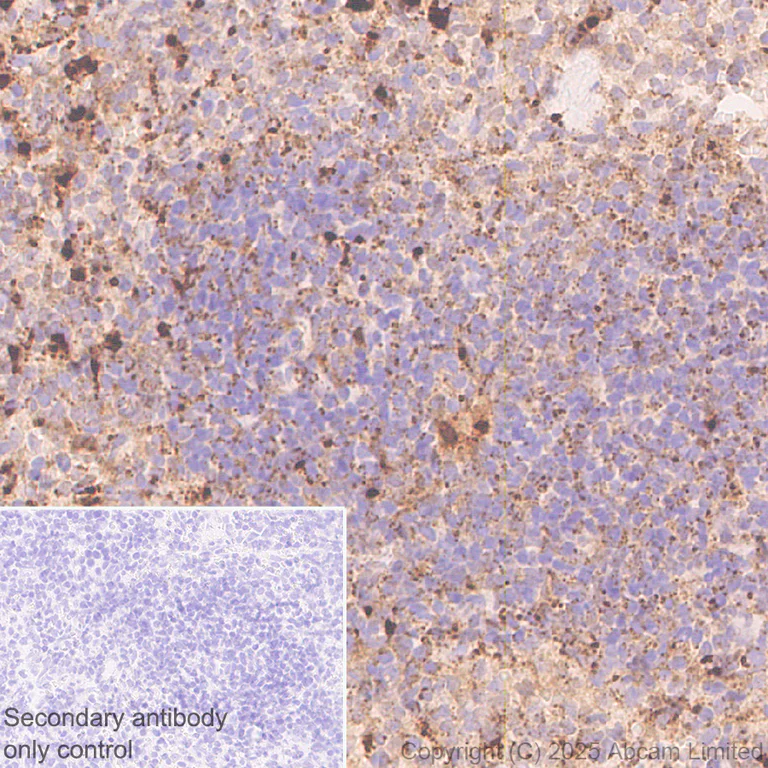 Anti-beta glucuronidase (GUSB) antibody [EPR30359-525] (ab324344) | Abcam