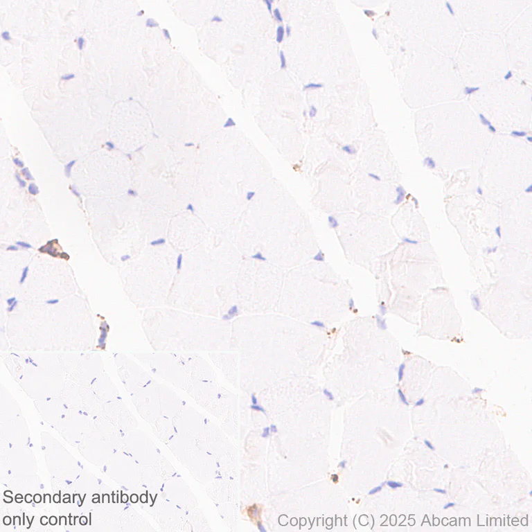 Anti-beta glucuronidase (GUSB) antibody [EPR30359-525] (ab324344) | Abcam