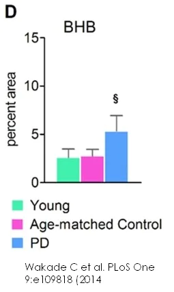 beta hydroxybutyrate test