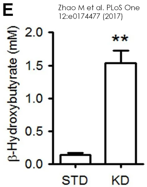 beta Hydroxybutyrate (beta HB)检测试剂盒 (Colorimetric) (ab83390)| Abcam中文官网