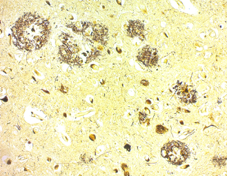 Bielschowsky Silver Stain Kit (ab245877) | Abcam