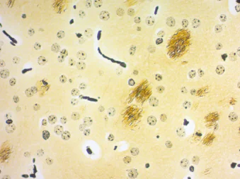 Bielschowsky Silver Stain Kit (ab245877) | Abcam