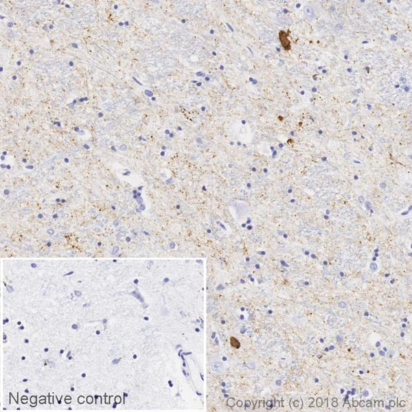 Biotin Anti-Alpha-synuclein aggregate 抗体 [MJFR-14-6-4-2] - Conformation ...