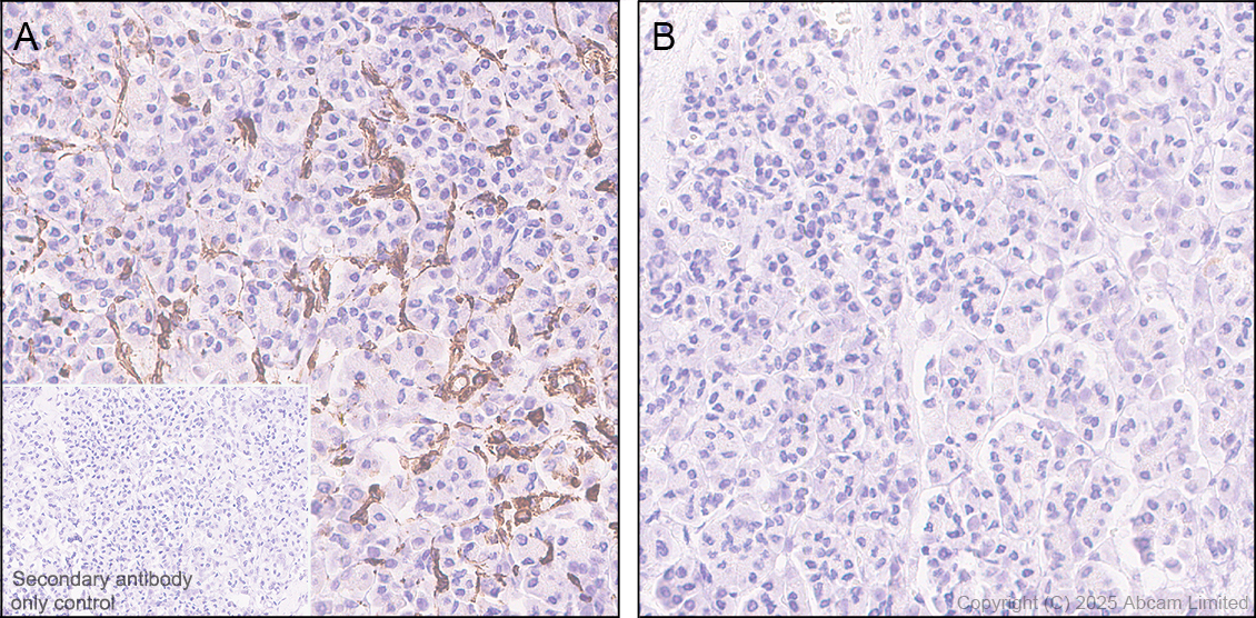 Anti-Biotin antibody [EPR28239-85] (ab324266) | Abcam