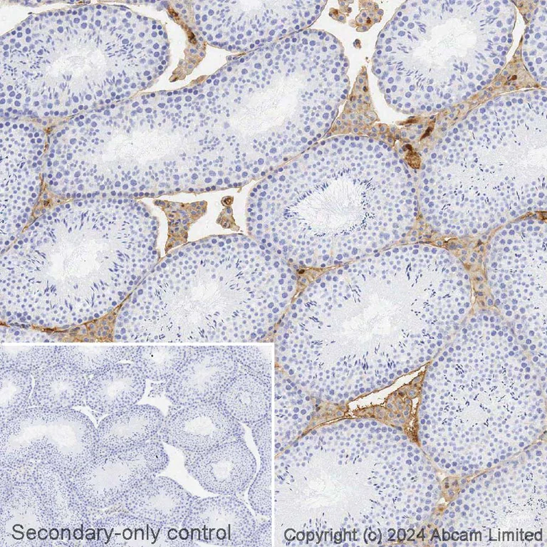 Biotin Anti-C3/C3b antibody [EPR19394] (ab322300) | Abcam