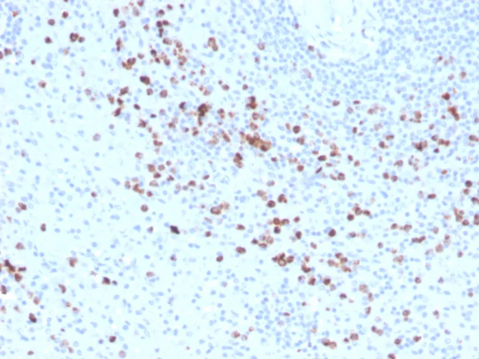 Biotin Anti-Granzyme B antibody [GZMB/3014] (ab271818) | Abcam