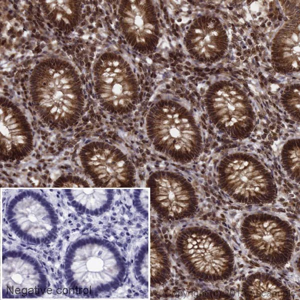 Anti-GRB2 Biotin antibody [Y237] (ab201539) Rabbit monoclonal IgG | Abcam
