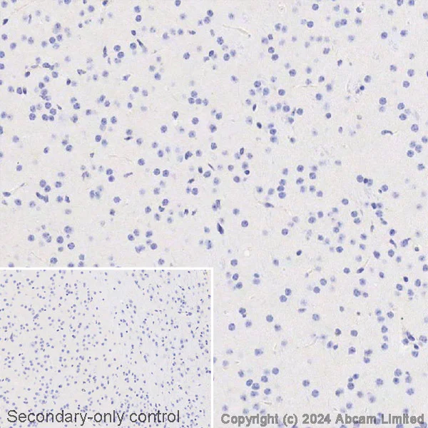 Biotin Anti-Uteroglobin antibody [EPR19846] (ab321781) | Abcam