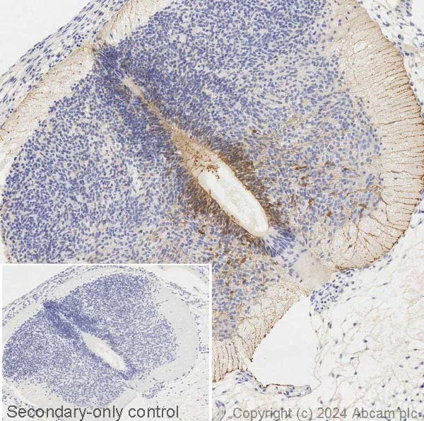 Anti-BLBP antibody (ab32423) | Abcam