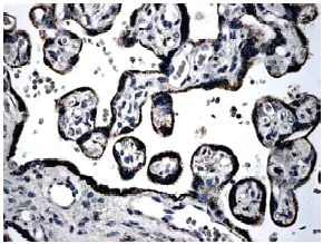 Anti-BMPR1B antibody [MM0055-3E12] (ab78417) | Abcam