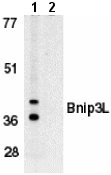 Anti-BNIP3L/NIX antibody (ab8399) | Abcam