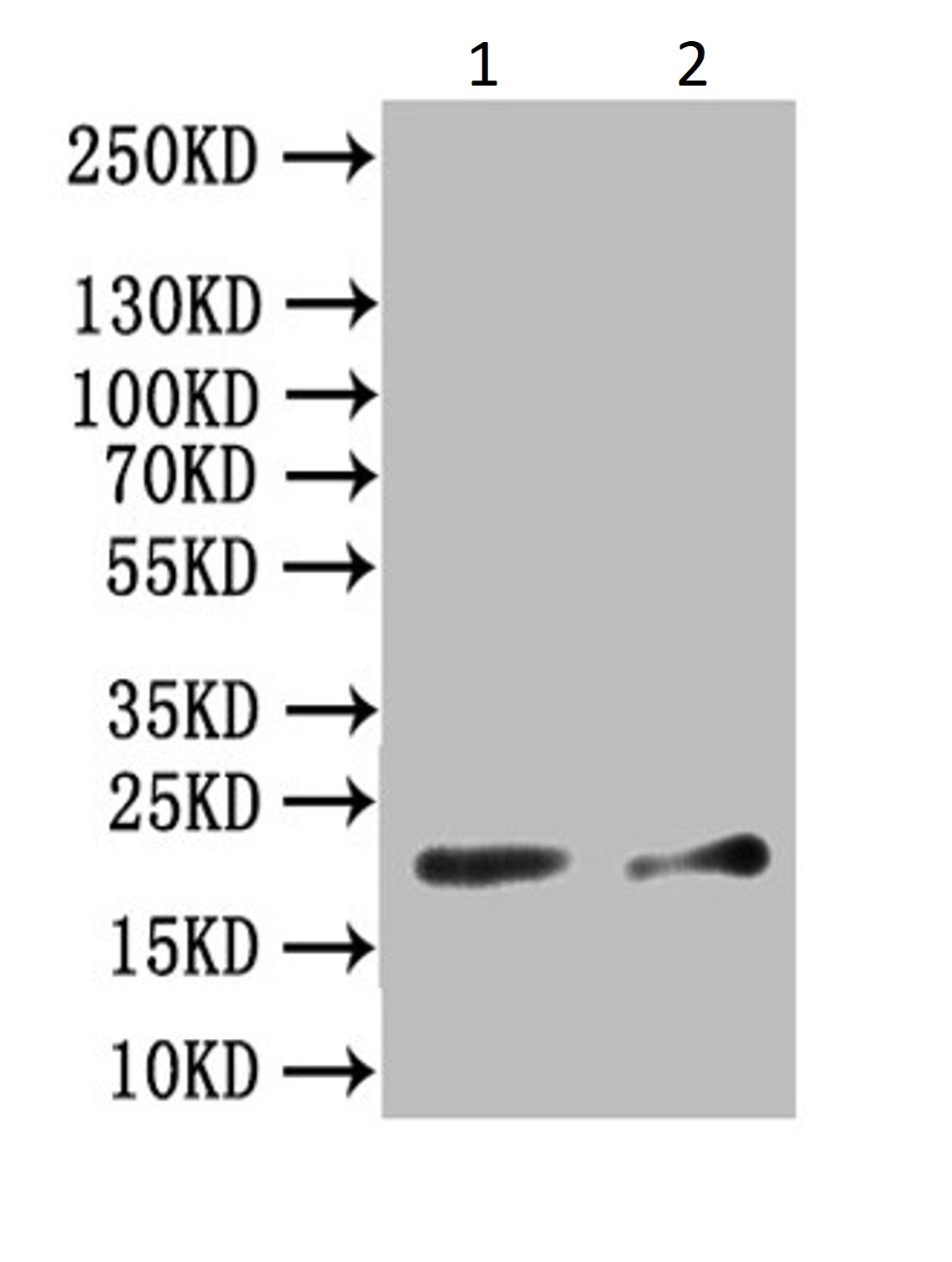 Anti-BNP antibody (ab236101) | Abcam