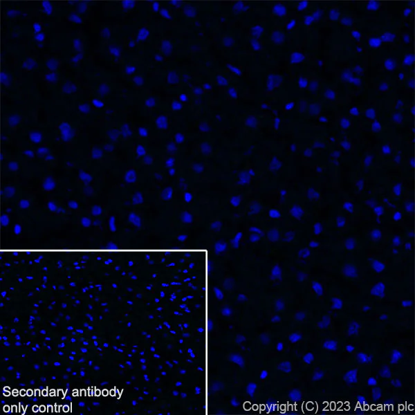 Anti-BNP antibody [EPR20260-222] (ab309127) | Abcam
