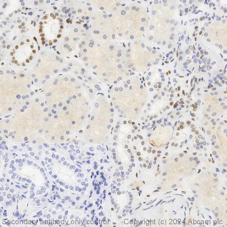 BOND RX - Anti-STAT3 (phospho Y705) antibody [EP2147Y] (ab325213) | Abcam