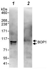 Anti-BOP1 antibody (ab86653) | Abcam