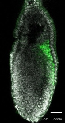 Anti-Brachyury / Bry antibody [EPR18113] (ab209665) | Abcam