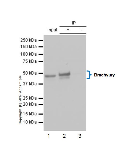 Anti-Brachyury / Bry antibody [EPR18113] (ab209665) | Abcam