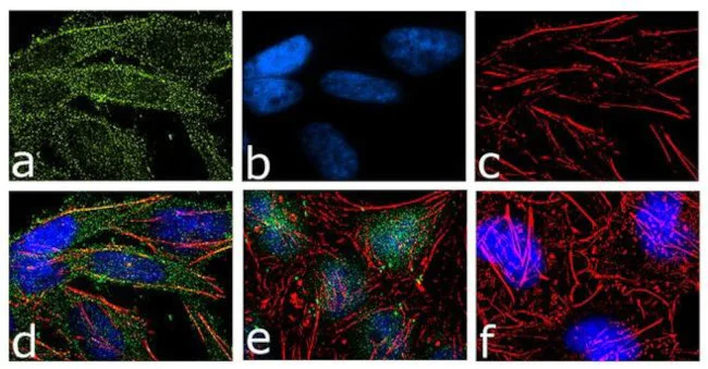 Anti-BRAF Antibody [RP23040159] (ab313460) | Abcam