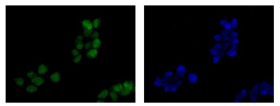 Anti-BRAT1 antibody [EPR13753] - C-terminal (ab181855) | Abcam