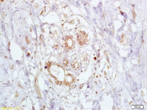 BRCA2抗体 (ab216972)| Abcam中文官网