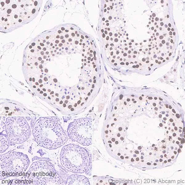 Anti-BRD1/BRL antibody [EPR12960] (ab181060) | Abcam