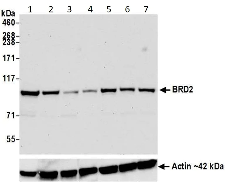 Anti-BRD2 抗体 [BL-167-2A2] (ab243865) | Abcam