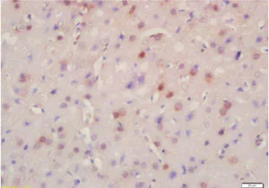 Anti-BRD8/p120 antibody (ab217850) | Abcam