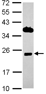 Anti-BRI3 antibody (ab101389) | Abcam