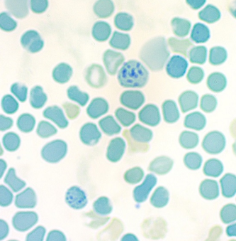 Brilliant Cresyl Blue Solution (1.5%) (ab246814) | Abcam