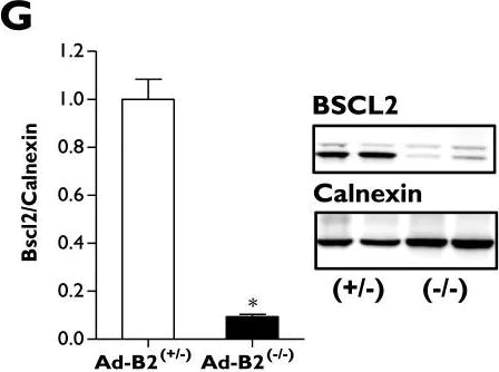 BSCL2/Seipin抗体 (ab106793)| Abcam中文官网